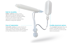 Coloplast Titan Before and After: Real Patient Results